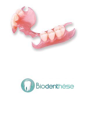Nos prothèse Adjointe : – Biodenthese